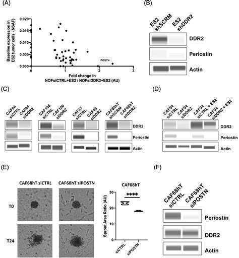 Figure 2 From DDR2 Expression In Cancer Associated Fibroblasts Promotes Ovarian Cancer Tumor