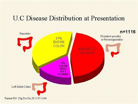 Diagnosis Management Of Ulcerative Colitis Epidemiology Ulcerative Colitis