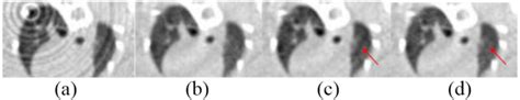 Figure 14 From A Cnn Based Hybrid Ring Artifact Reduction Algorithm For