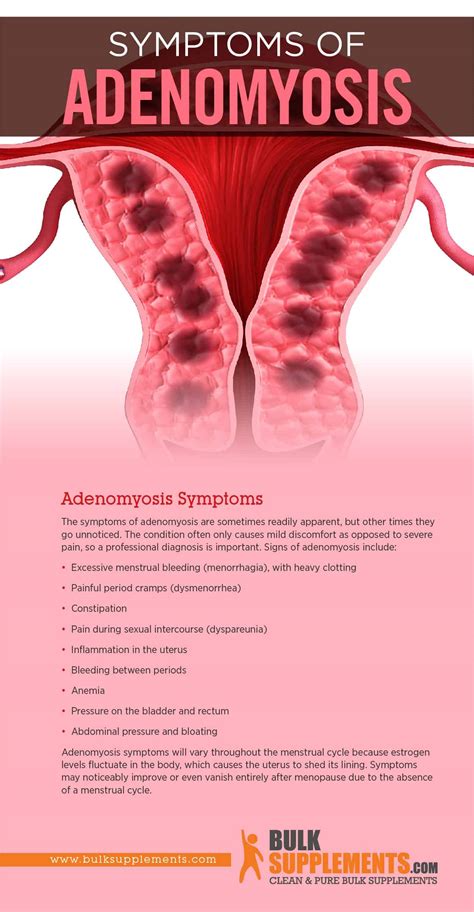 What Is Adenomyosis Causes Symptoms And Treatment