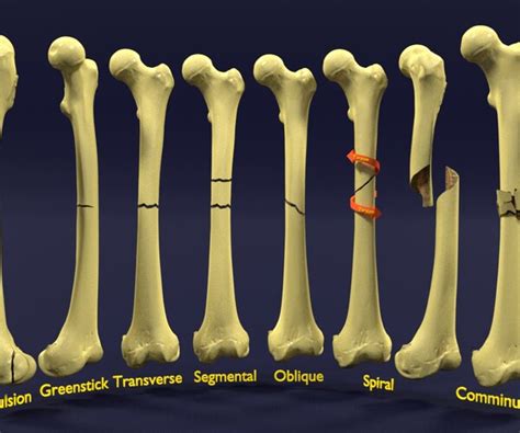 Artstation 3d Model Fracture Types Labelled Resources
