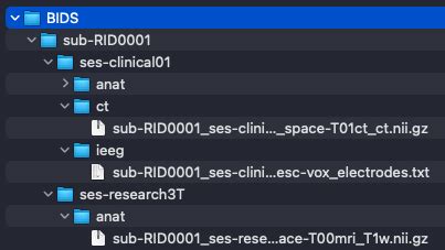 Running The App Ieeg Recon Documentation