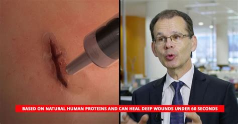 Check Out This Surgical Glue Which Heals Wounds Without Stitches Must Read