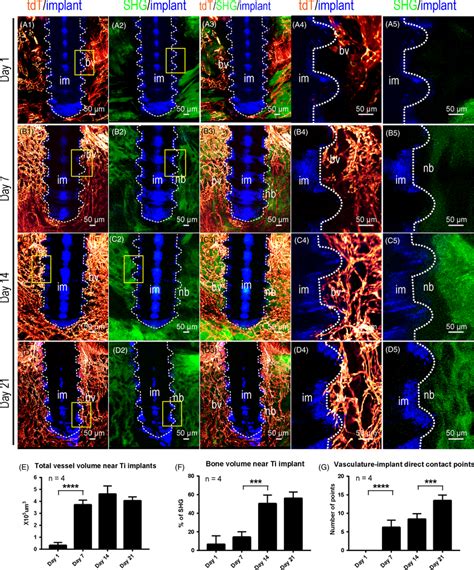 Three‐dimensional Analysis Indicates The Progressive Angiogenesis And