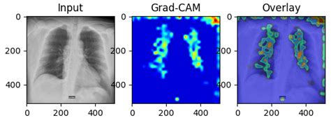 Gradient Weighted Class Activation Mapping Grad Cam Visualization Of Download Scientific