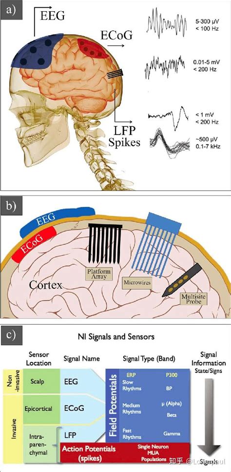比头发丝儿还细的线如何获取大脑信号——解密马斯克neuralink电极工艺 知乎