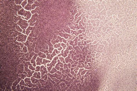 Gist Bij De Microscoop Stock Foto Afbeelding Bestaande Uit