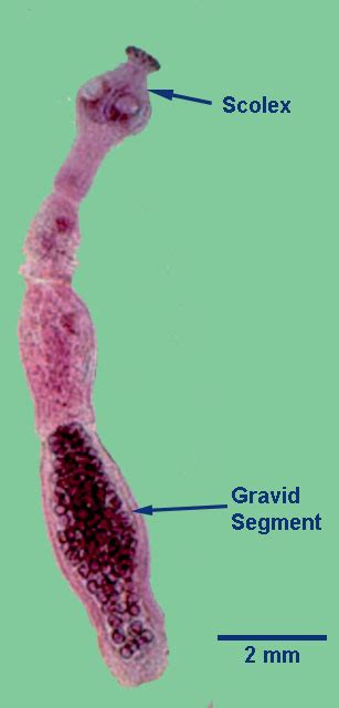 Echinococcus Multilocularis Learn About Parasites Western College