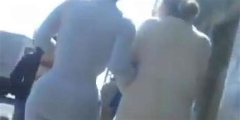 Free Deformity Porn Videos And Sex Movies Tnaflixcom