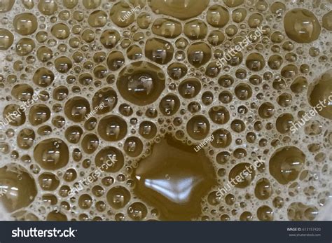 Bubbles In Urine Hiv At Sandra Raines Blog