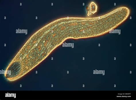 Spirostomum Under Microscope