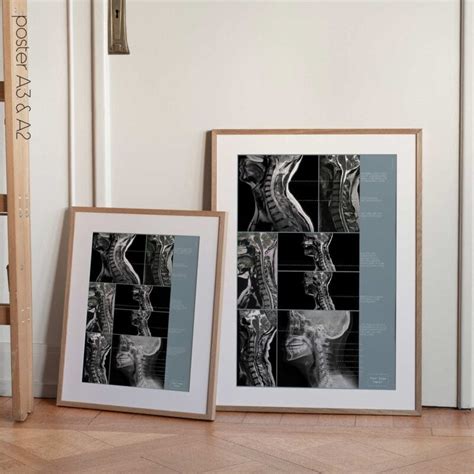 Cervical Pathology Educare Design