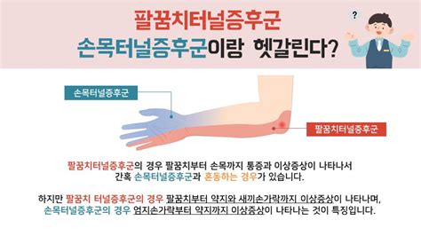 조은마디병원이 알려드리는 질환상식 팔꿈치터널증후군 건강정보 조은마디병원
