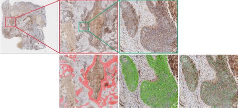 Examples Of Intermediate Images In The Atpss Pipeline From Left To
