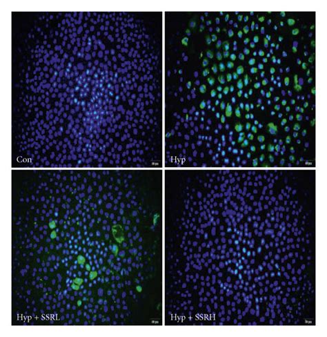 Shen Shuai Ii Recipe Ssr Inhibits Interleukin Il 1β Expression In