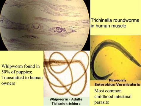 Flatworms Roundworms Notes Ppt