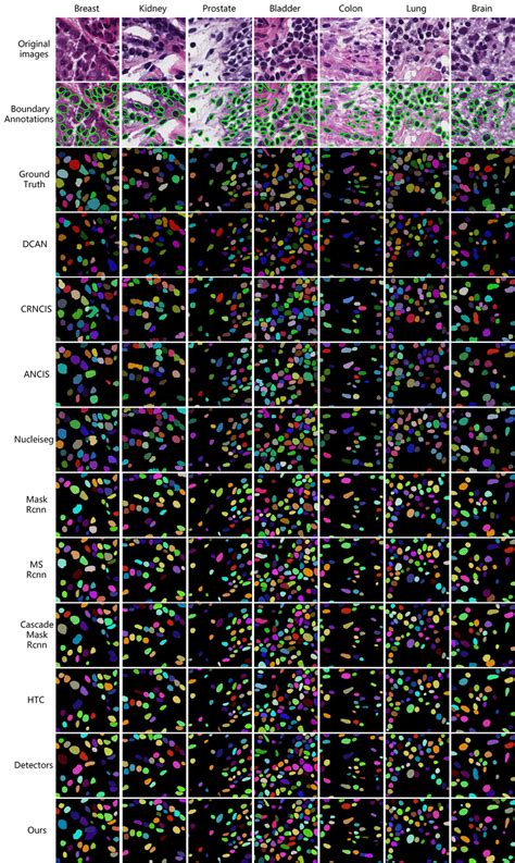 visual comparisons to different instance segmentation methods on