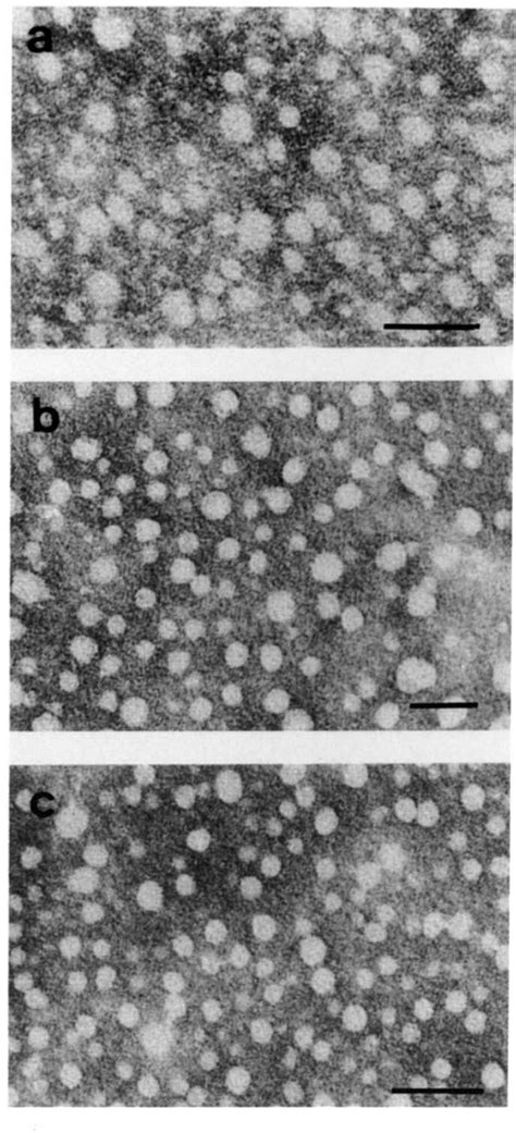 Electron Micrographs Of A Hdl B Hdl Lpaiwoaii Particles C
