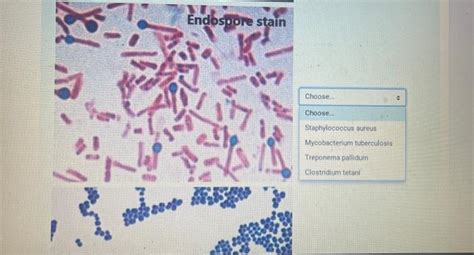 Solved Identify Each Bacterium Shown Choose