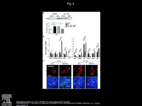 Metformin Ameliorates Uterine Defects In A Rat Model Of Polycystic Ovary Syndrome Yuehui Zhang