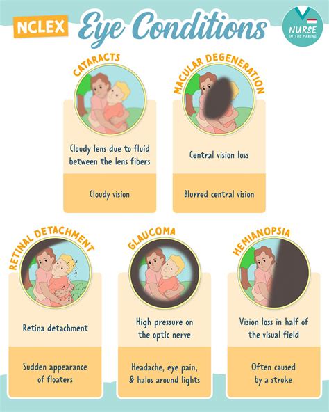 Nclex Eye Conditions 👀cataracts Nurse In The Making