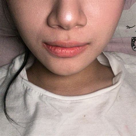 시술 수술 질문 진짜 어릴 때부터 강남언니 1등 성형수술and피부시술 정보앱