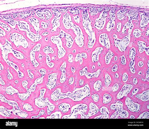 Light Micrograph Of A Cross Sectioned Immature Bone Diaphysis The