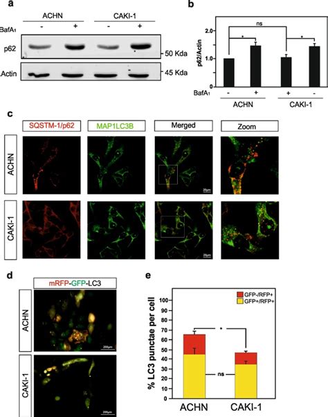 Setd2 Mutation In Renal Clear Cell Carcinoma Suppress Autophagy Via Regulation Of Atg12 Pmc