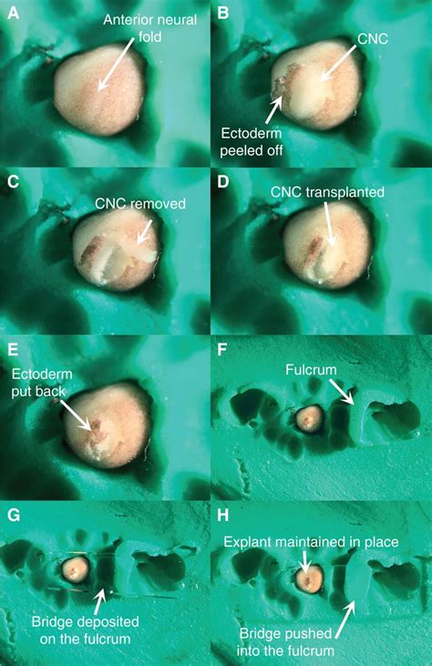 cranial neural crest transplants