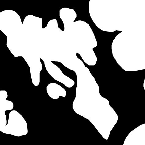 Github Sarah Antilliatensorflow Image Segmentation Rings Prostate