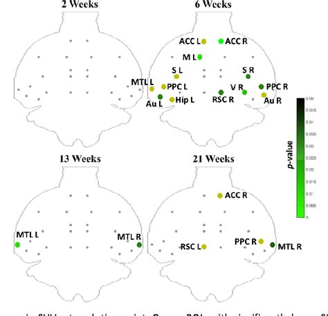 Figure 1 From Spatio Temporal Alterations In Functional Connectivity