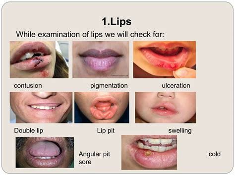 Intra Oral Examination Pptx