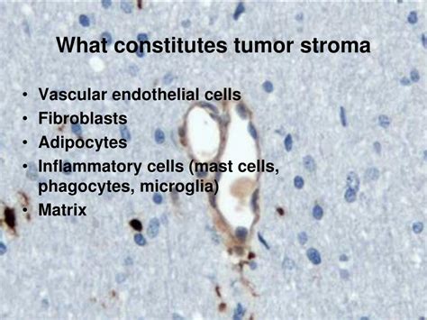 Ppt Stromal Influences On Brain Tumor Formation And Growth Powerpoint