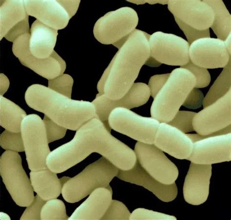 Bifidobacterium Gram Stain