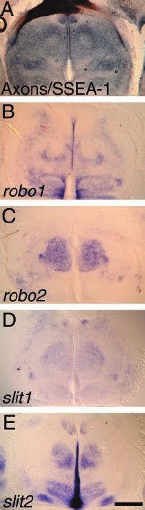 Expression Of Robos And Slits In The Ventral Diencephalon Of E175