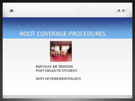 root coverage procedures