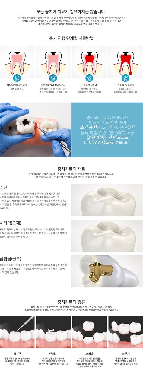 충치치료 닥터고치과