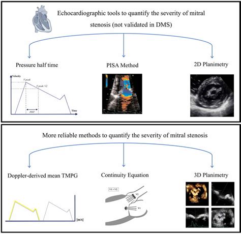 Echocardiographic Tools To Quantify The Severity Of Mitral Stenosis