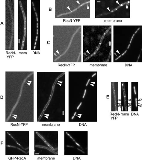 Fluorescence Microscopy Of Cells Expressing Recn Yfp As The Sole Source