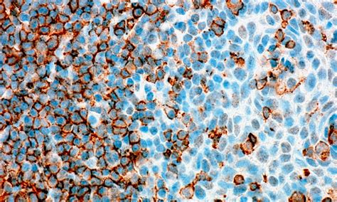 Anti Cd43 T Cell Leukosialin Biogenex