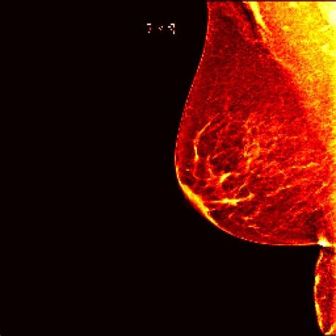 Breast Cancer Medical Imaging Colorized Dataset Kaggle