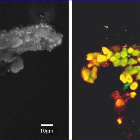 Detection Of Bacteria In The Obsidian Sample From A Thin Section The
