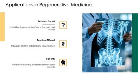 Endochondral Ossification Histology Ppt Example Acp Ppt Template
