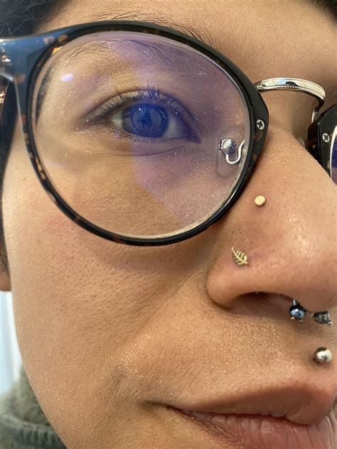 High Nostrils Embedding Or Just Swollen R Piercing