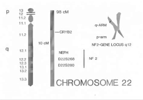 Flanking Markers Indicating Location Of Nf2 Gene In Chromosome 22 Download Scientific Diagram