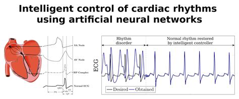Intelligent Control Of Cardiac Rhythms Smart Systems