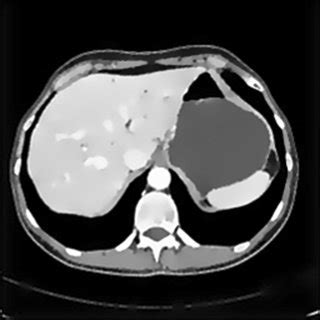 Anisotropic Filtering A Original Image B Filtered Image Download Scientific Diagram