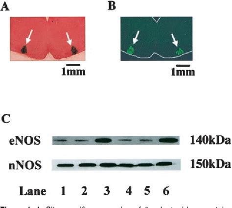 Nos3 Gene Semantic Scholar