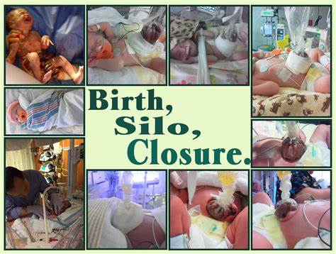 Frequently Asked Questions The Global Gastroschisis Foundation