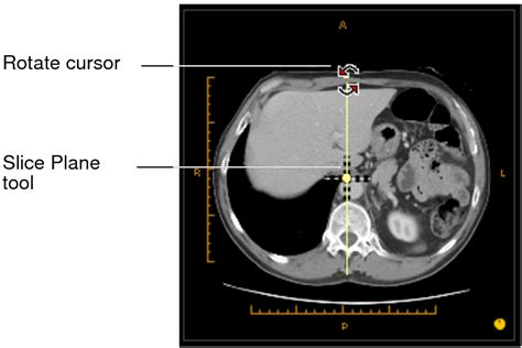 Viewing Orthogonal Multi Planar Reformats